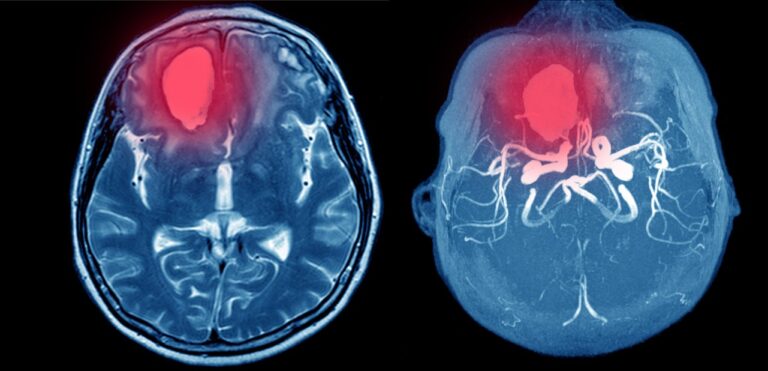 The Importance of STAT and Emergency MRI Services at GWIC - Greater ...
