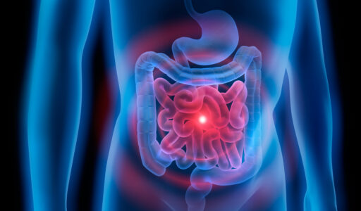 Small Bowel Disease - Greater Waterbury Imaging Center