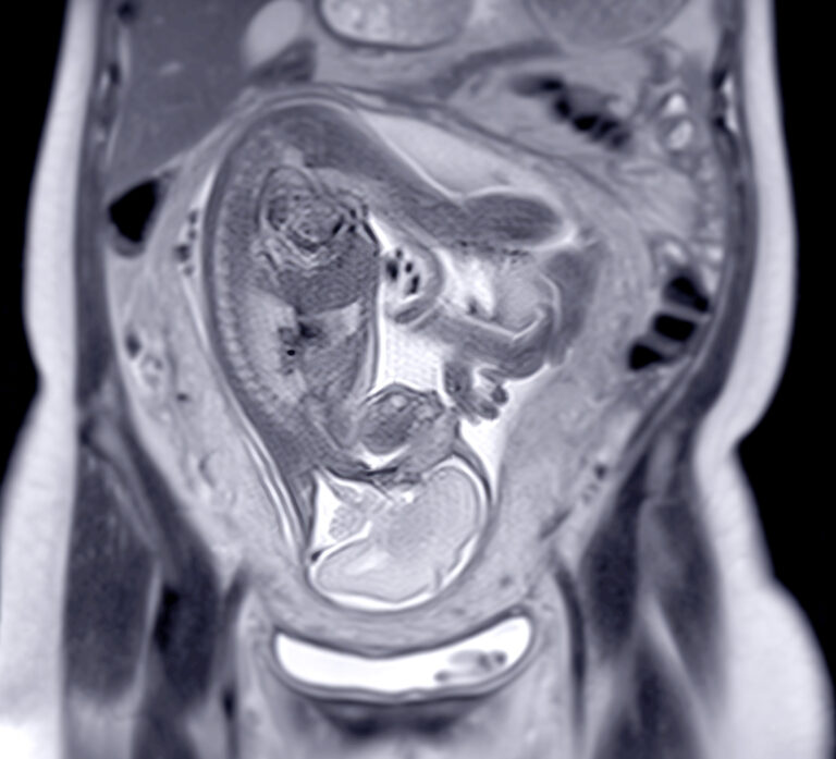 Pregnancy - Greater Waterbury Imaging Center